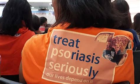 Psoriasis Not Contagious Must Not Cause Stigma