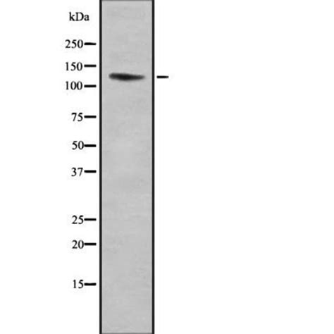 Itga11 Polyclonal Antibody Invitrogen 100 μl Unconjugatedantibodies
