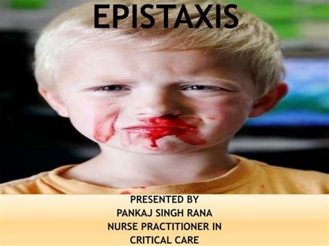 Gcs Glasgow Coma Scale Ppt