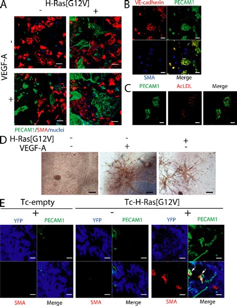 Figure 1 From Ras Signaling Directs Endothelial Specification Of Vegfr2 Vascular Progenitor