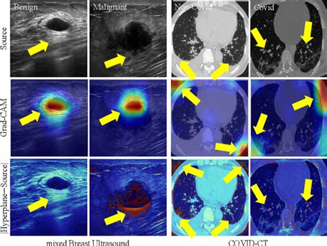Figure 1 From A Parameterized Generative Adversarial Network Using Cyclic Projection For