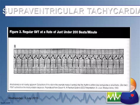 Defibrillation And Cardioversion Ppt