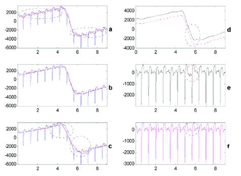 Comparison Between The Proposed Method And The Wt Based Method Ptb