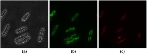 Examples Of Bright Field And Fluorescent Yeast Cell Image A The