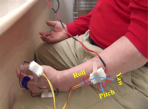 Quantitative Measurement Of Resting Tremor Using 3 Axis Gyro Sensors