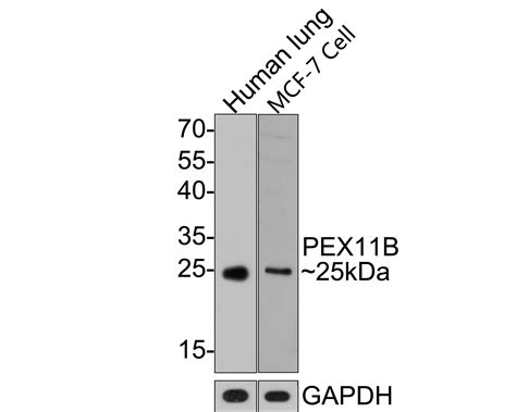 Pex11b Recombinant Rabbit Monoclonal Antibody Je64 51 Ha721124 Huabio
