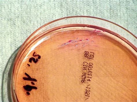 Image Libre Yersinia Pestis Les Bactéries Lapparence Coloniale