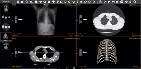 云胶片云pacs源码云胶片代码 Csdn博客