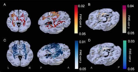 Extensive Network Of White Matter Microstructure Integrity Is Related To Download Scientific