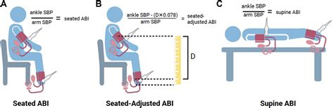 Optimizing Ankle Brachial Index Measurement For Peripheral Arterial