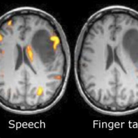 Pdf A Survey On Deep Learning Based Brain Computer Interface Recent