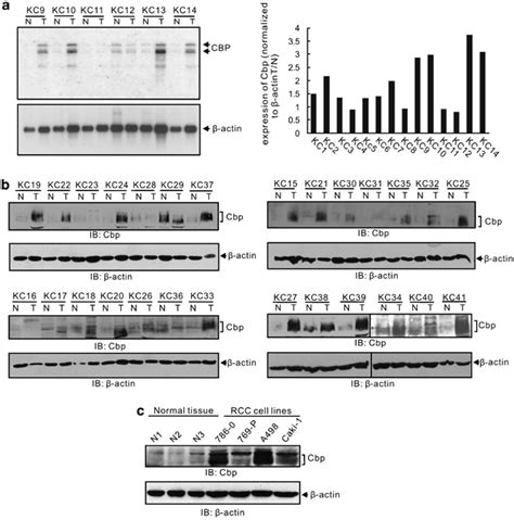 c terminal src kinase csk binding protein cbp expression in renal