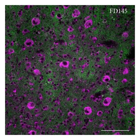 Perineuronal Nets In The Developing Cerebellar Nucleus Perineuronal Download Scientific