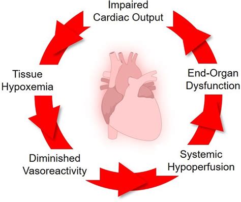 Cardiogenic Shock