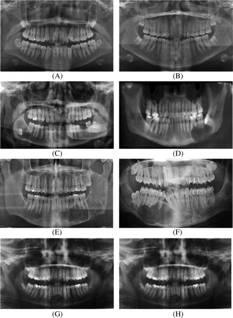 Classification Results Of The Modified Convolutional Neural Network Download Scientific Diagram