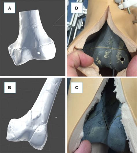Experimental Validation Results Examples Virtual Reduction In The Download Scientific Diagram