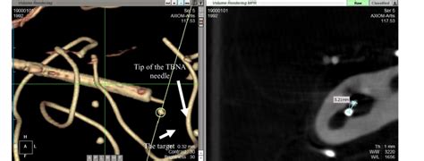 Visualization From Dynact Scan From The Third Experiment The Left