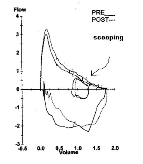 Pulmonary Function Test The Pulmonary Function Test Was Performed