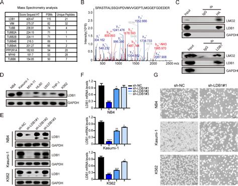 Lmo2 Promotes The Development Of Aml Through Interaction With Transcription Co Regulator Ldb1 Pmc