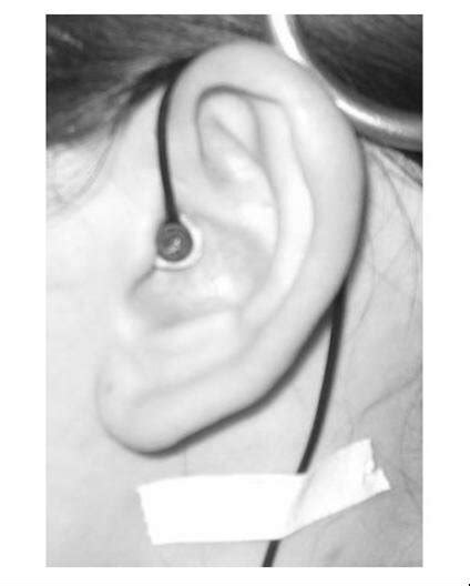 A Blocked Ear Canal Scheme For Microphonic Signal Data Capture [8] Download Scientific Diagram