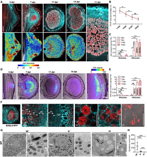 Soybean Symbiotic Nodule Zonation And Cell Differentiation Are Defined By Nin2 Signaling And Gh3