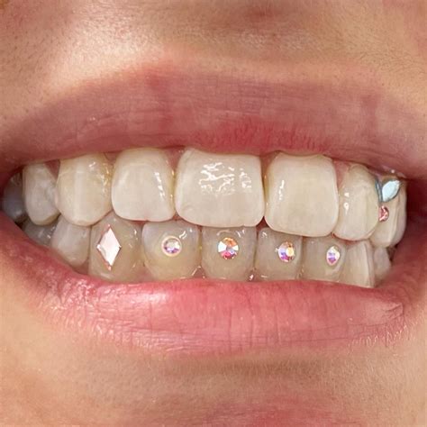Tooth Gems Pearly Whites