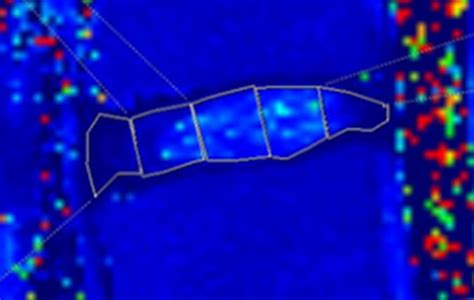 Illustration Of Ivd Segmentation Download Scientific Diagram