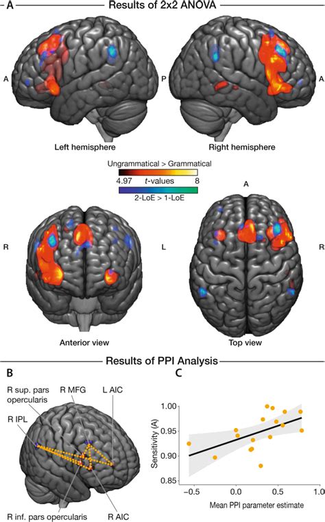 The Right Inferior Frontal Gyrus Processes Nested Non Local Dependencies In Music Pmc