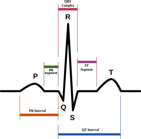 Normal Ecg Trace Sinus Rhythm Comprising The P Wave Representing