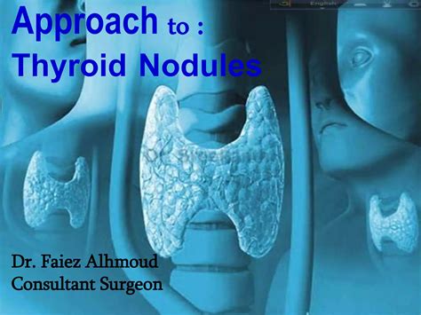 Approach To Thyroid Nodulepptx