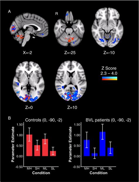 Reduced Response In Visual Cortex When Proprioceptive Input Is High In