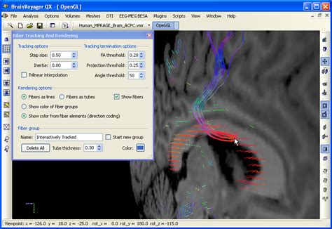 Interactive Fiber Tracking