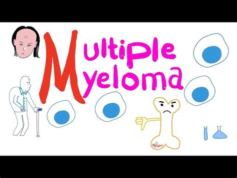 Free Video Multiple Myeloma A Malignancy Of Plasma Cells From Medicosis Perfectionalis