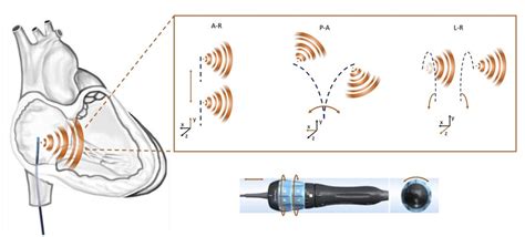 Schematic Representation Of Different Manipulation Options Of A Phased