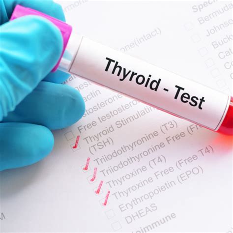 Thyroid Function Test TFT 1S Pharma Xonline