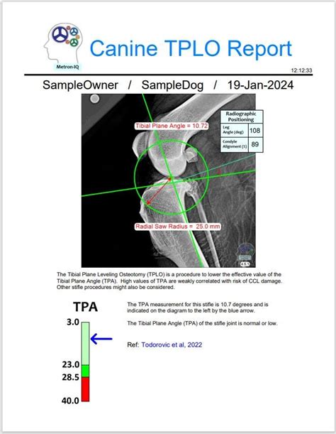 Metron Iq — Metronmind