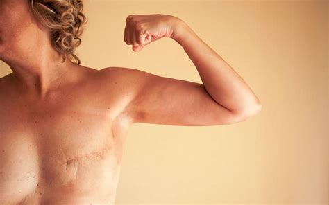 Breast Reconstruction After Mastectomy The Different Techniques