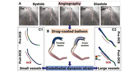 Angiography Based Computational Modeling For In Vivo Assessment Of Cardiovascular Innovations
