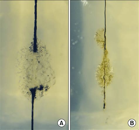 Examples Of Simulated Laser Light Tissue Interactions Using Download Scientific Diagram
