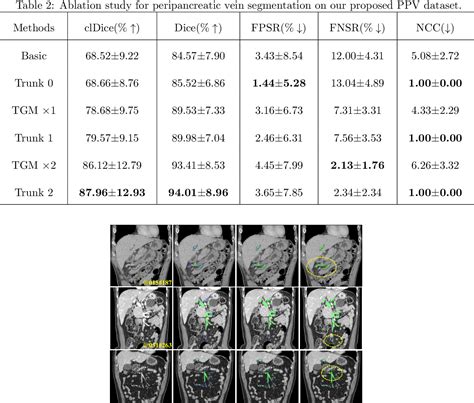 Automated Peripancreatic Vessel Segmentation And Labeling Based On Iterative Trunk Growth And