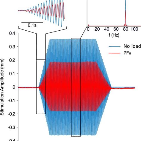 Minimum Stimulation Amplitude Amplitude Threshold AT Eliciting An Download Scientific
