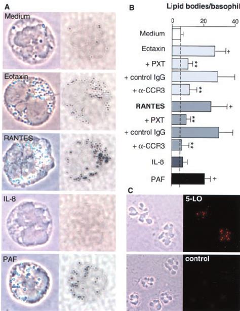A Much Of The Staining Was In A Linear Perinuclear Pattern Although Download Scientific