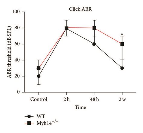 Abr Threshold Shifts Following Noise Exposure Between Myh14−− Mice And