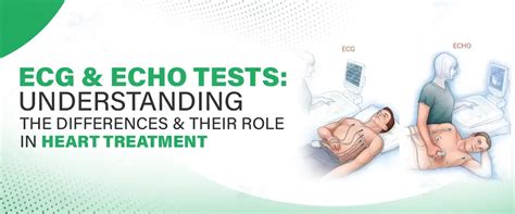 Ecg And Echo Tests Understanding The Differences And Their Role In