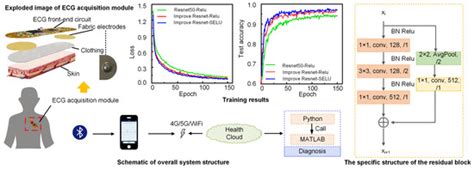 sensors free full text artificial intelligence enabled ecg