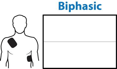 Monophasic Vs Biphasic Waveform Defibrillation