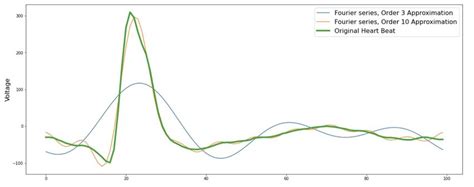 Example Of Kernel Cross Correlation Of Ecg Data With A Pre Computed