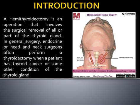 Hemithyroidectomy Surgery Ppt Download