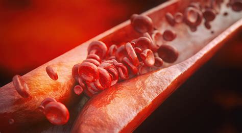 Aterosklerosis Gejala Penyebab Dan Pengobatan Halodoc