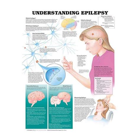 Epilepsy Chart Keski